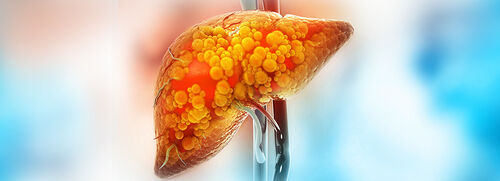 Alkohol und seine schädigende Wirkung auf die Lebergesundheit · MVZ ...